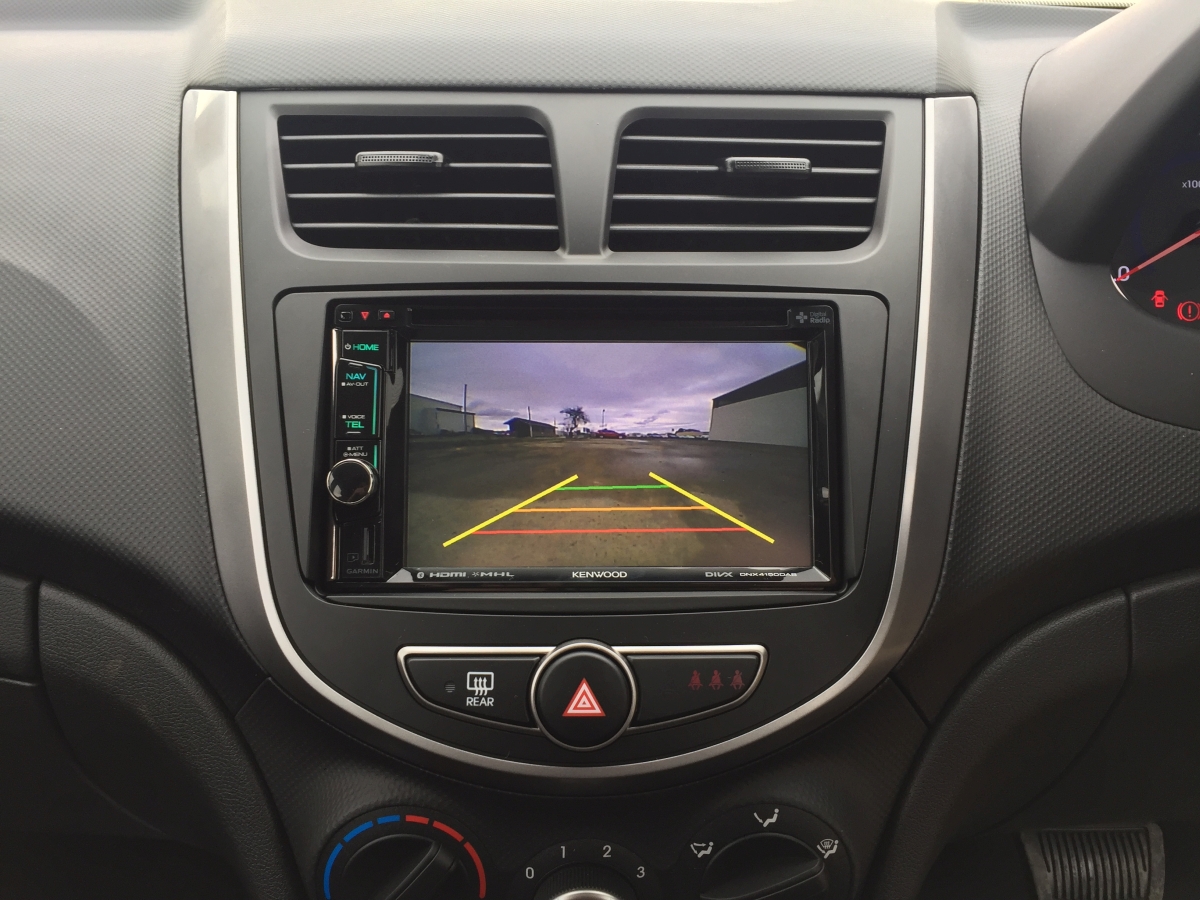 Accent 2016 Kenwood DNX4150DAB Sat Nav | Creative Installations
